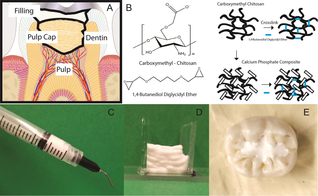 Rapidly Curing Chitosan Calcium Phosphate Composites as Dental Pulp ...
